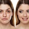 Most Common and Popular Cosmetic Surgeries | Health News - Business ...