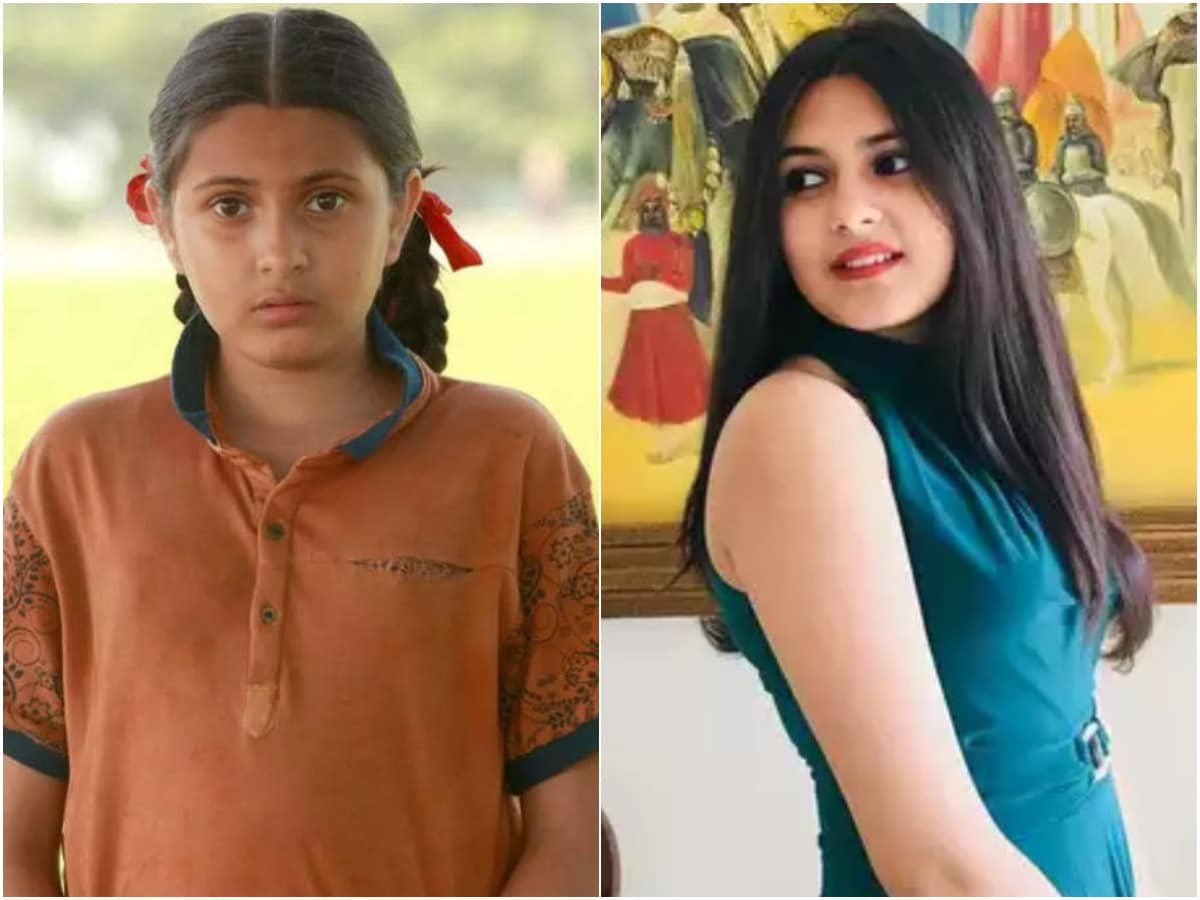 Dermatomyositis: Disease that caused the demise of Suhani Bhatnagar | Entertainment News ...