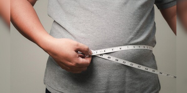 Need to recognise obesity as chronic disease for better management ...