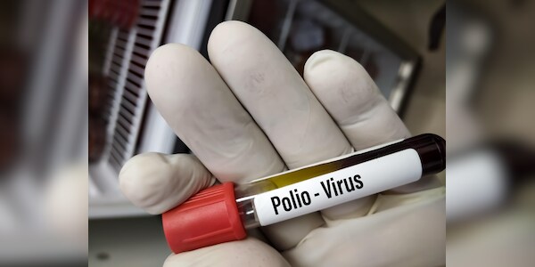 The world nearly beat polio, but missteps and fake records revived it | World News - Business ...