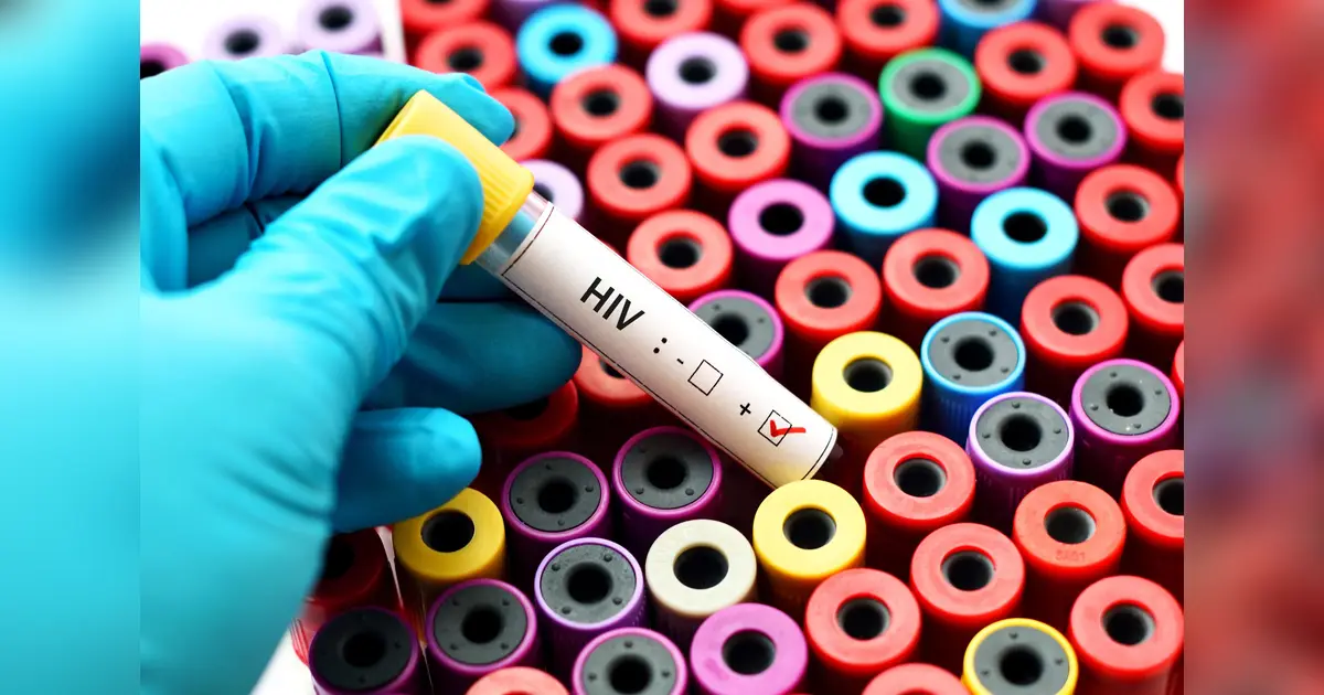 'Bluetoothing': Blood-sharing drug trend fuels alarming global HIV ...