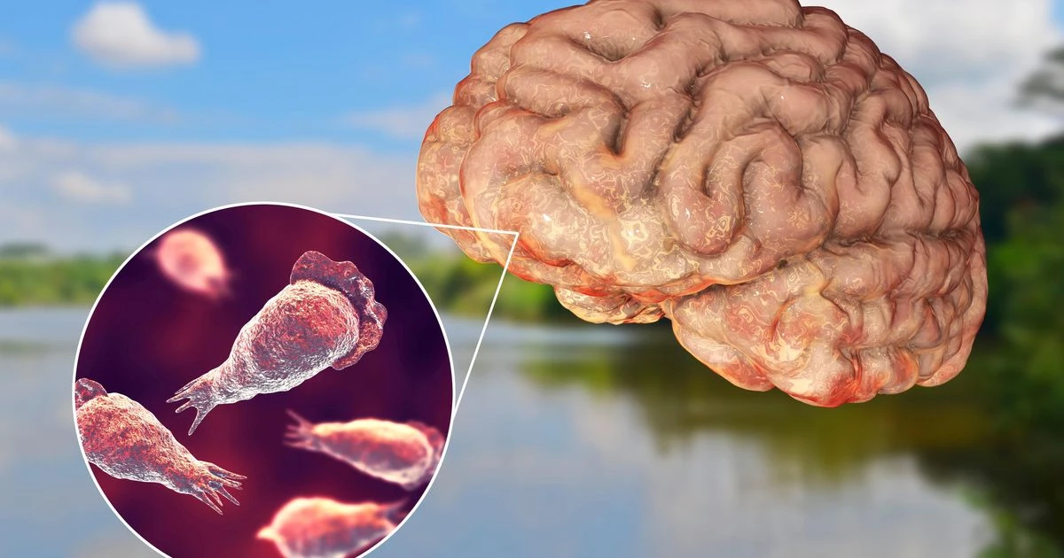 Climate change may be fuelling a global rise in deadly brain-eating ...