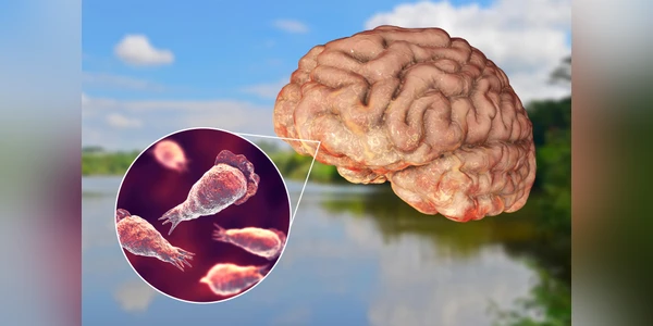 Rare but ruthless: Deadly brain-eating amoeba claims 19 lives in Kerala ...