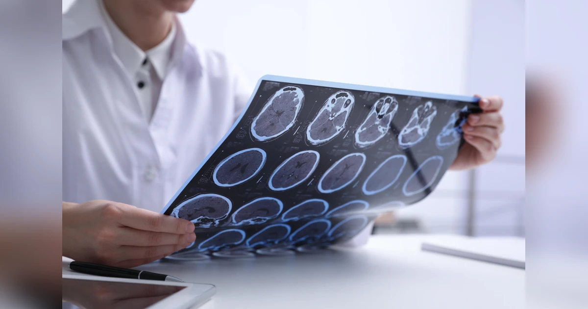 Does cold weather trigger an MS flare-up? Experts explain the real risk ...