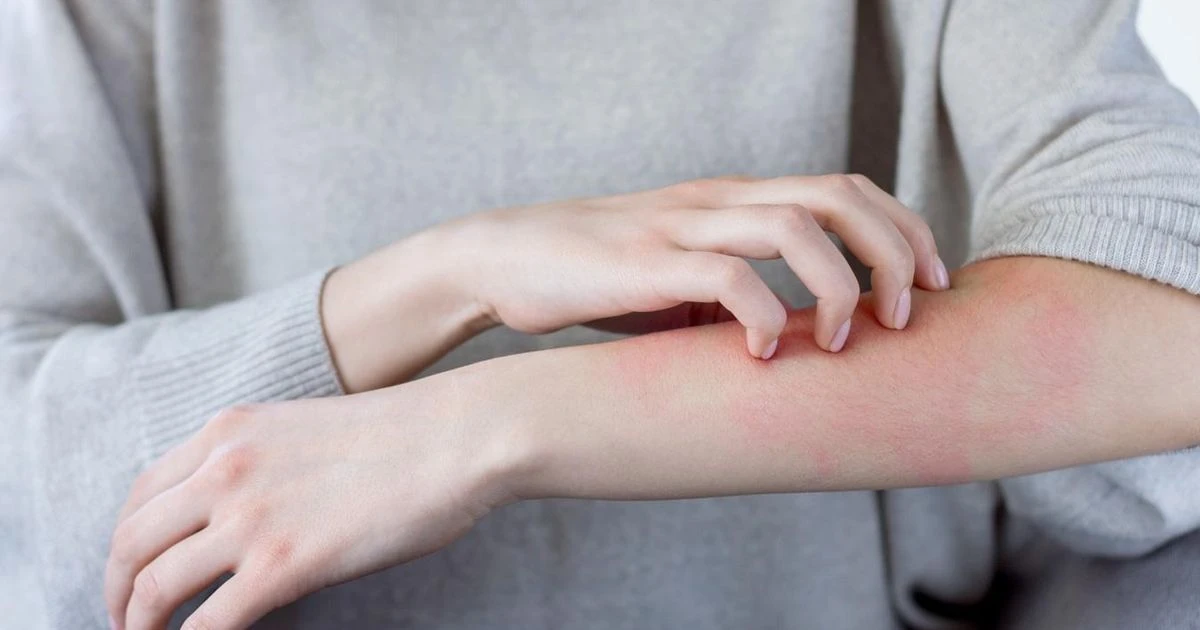 Why your itch gets worse when you scratch it, skin damage and what to ...
