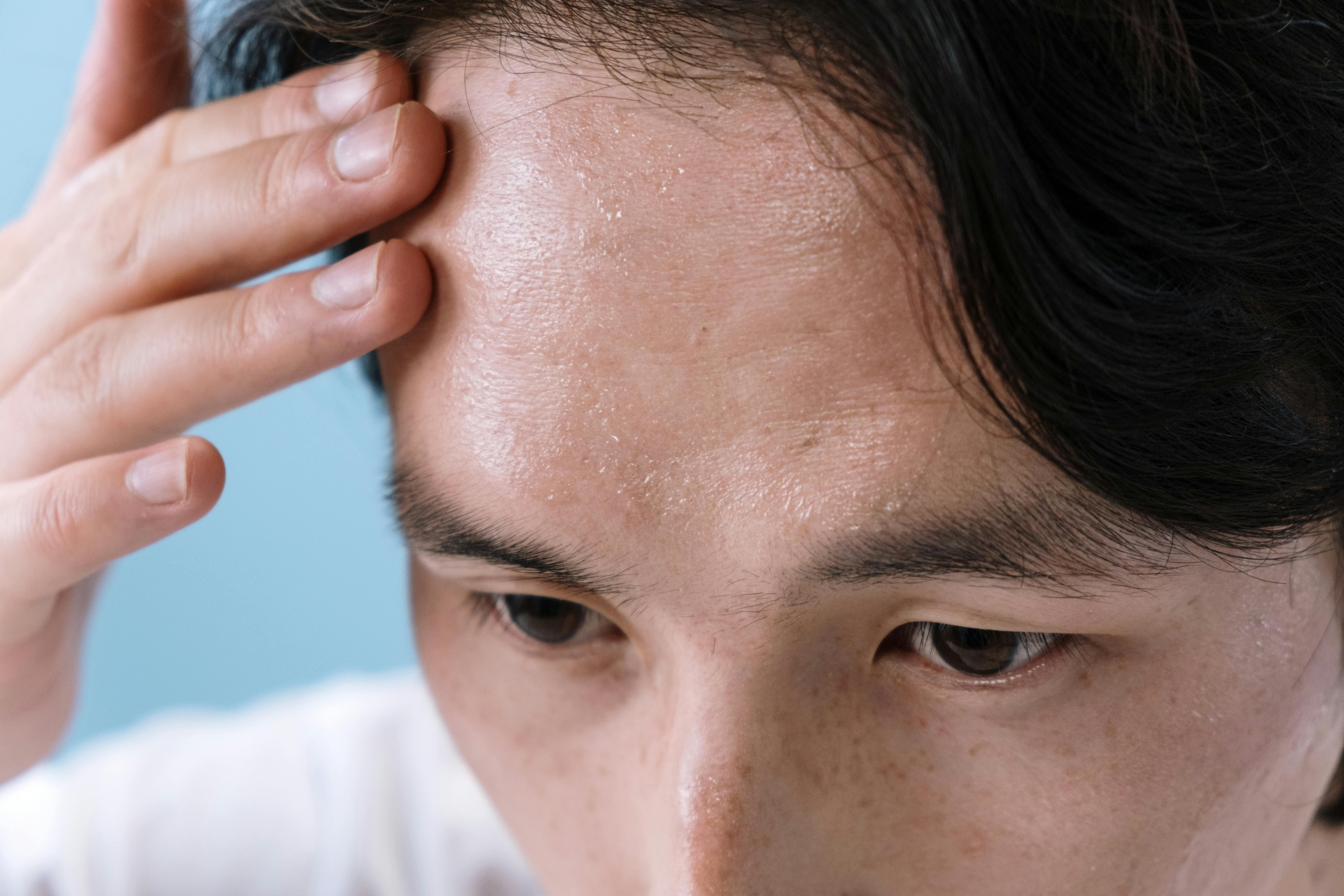 Recurrent night sweats: What they mean and when you should worry ...