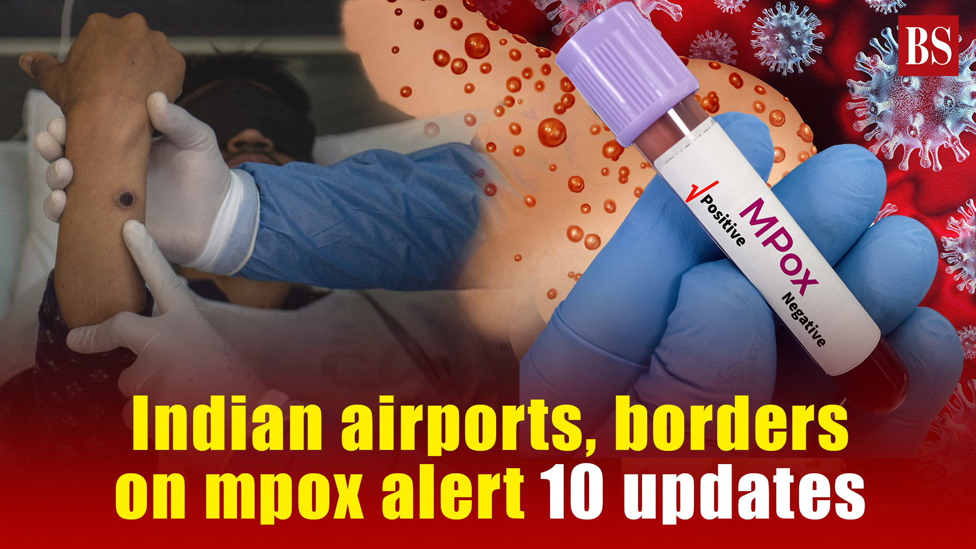 Mpox virus: India on alert; 10 things you need to know