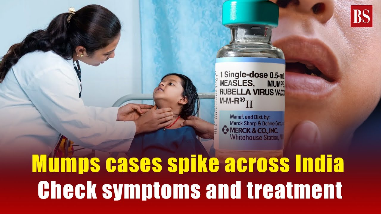 Mumps cases spike across India; Check symptoms and treatment