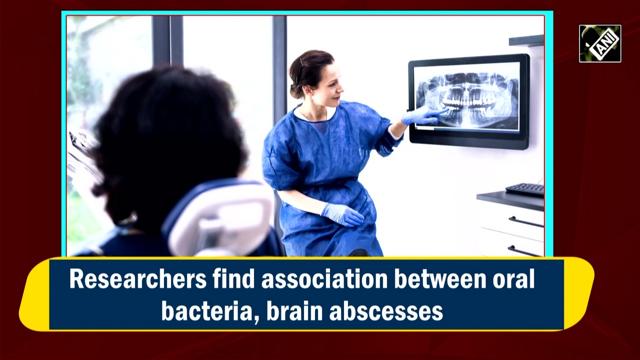 Researchers find association between oral bacteria, brain abscesses